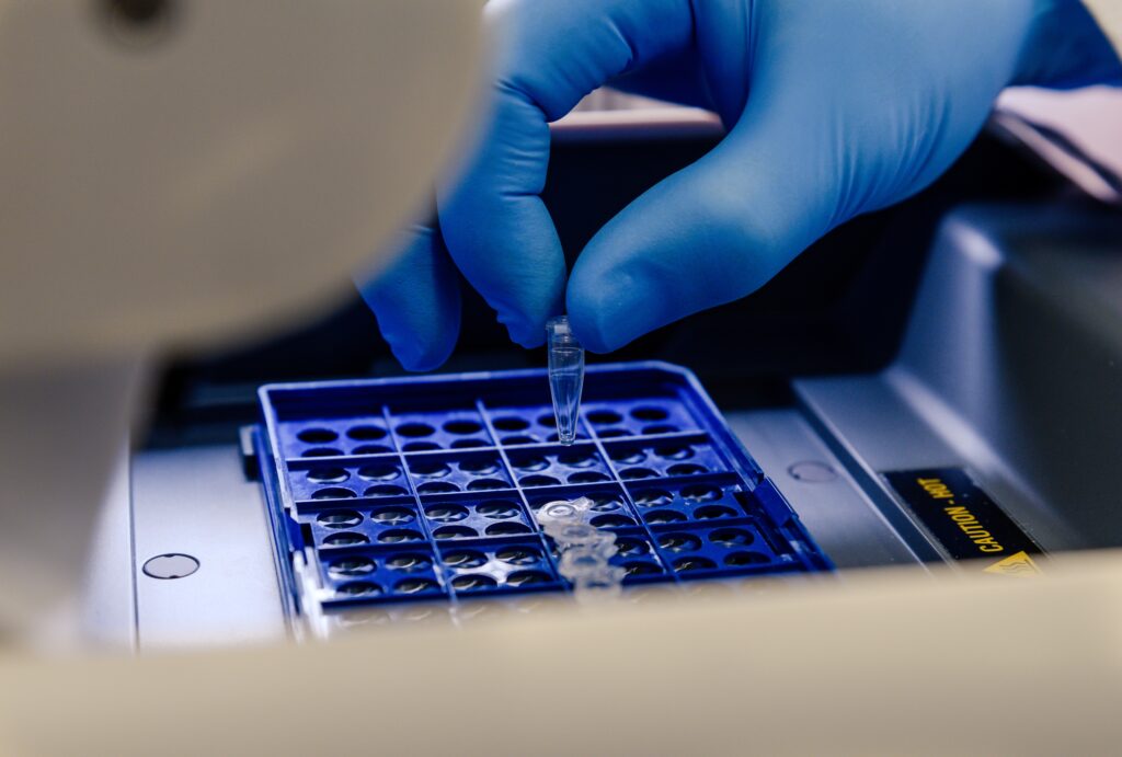 How to Choose the Right PCR Machine for Your Lab | AlGENOME SHOP