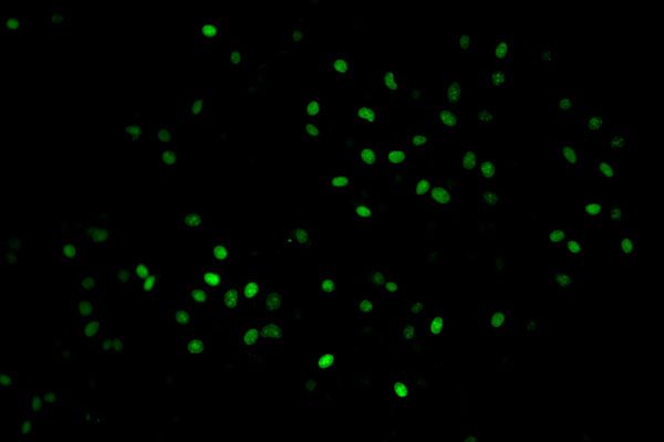 EdU assay kit :: Cell Proliferation EdU Assay Kit 100 Test | AlGENOME SHOP